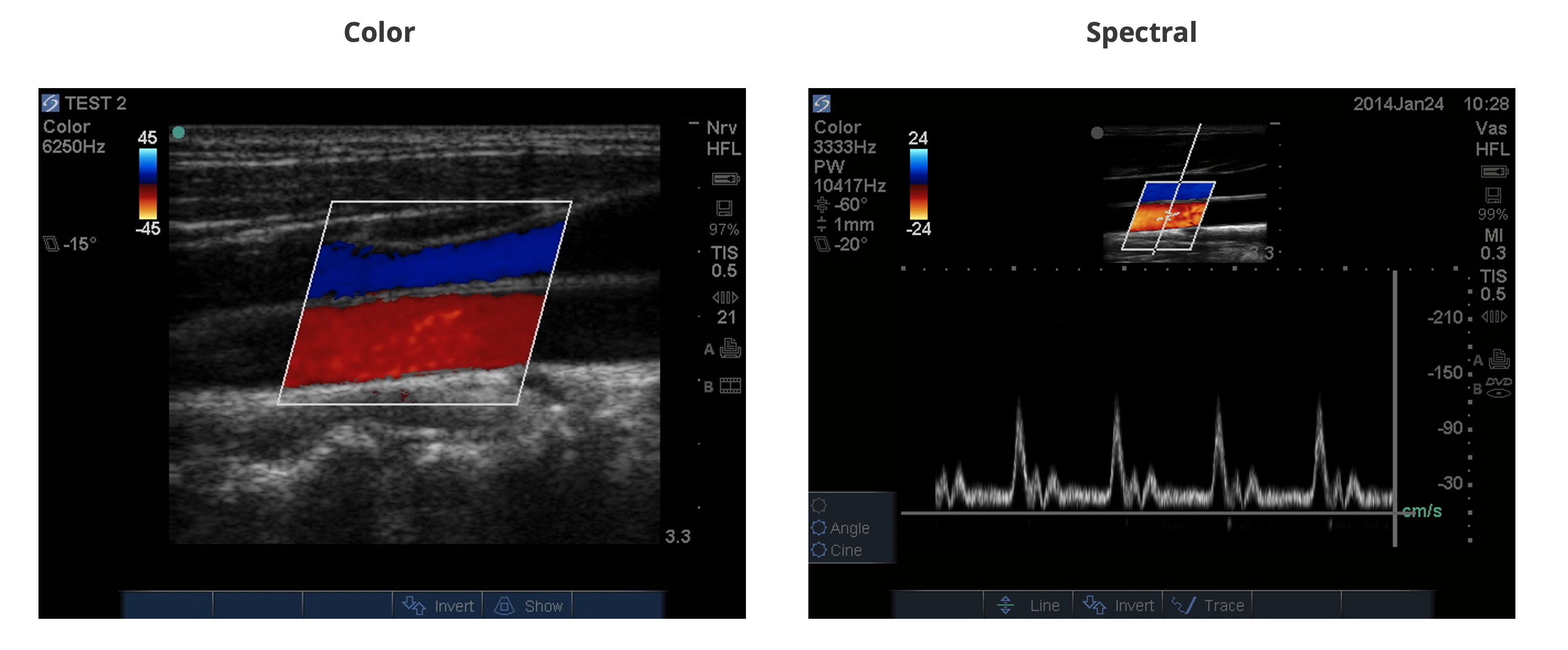 Doppler & Color Doppler – Atomic Anesthesia