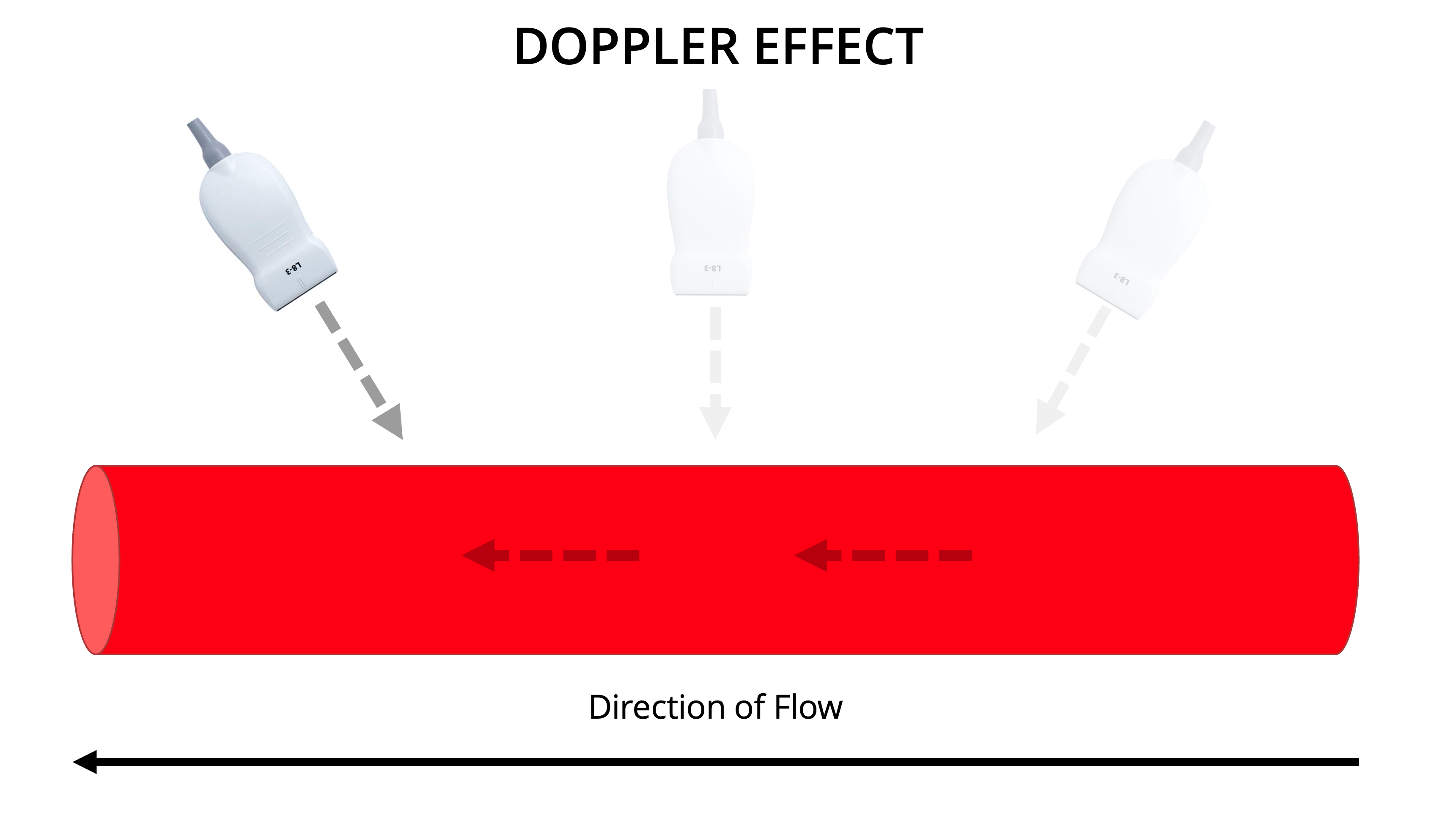 Doppler & Color Doppler – Atomic Anesthesia